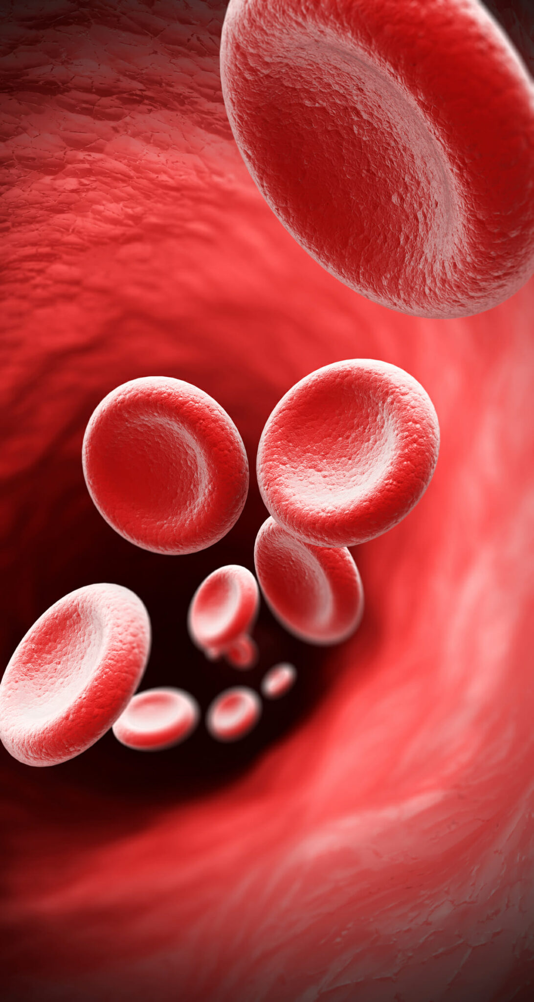 Iron-Deficiency Anemia: Symptoms and Treatment - Solstice Health & Wellness